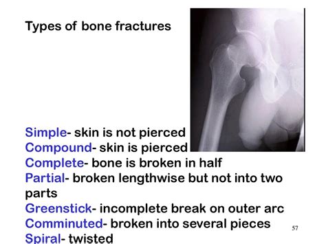The Skeletal System Ppt Download