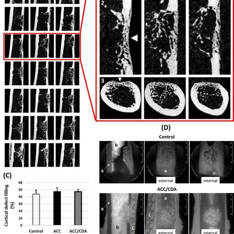 Schematic Illustration Of The Two Main Microcomputed Tomography μct Download Scientific
