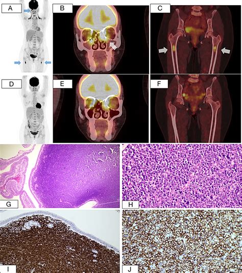 Clinical Nuclear Medicine