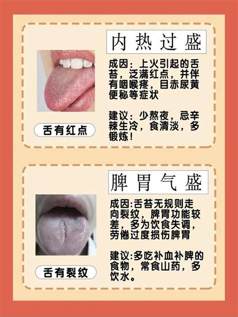 6种常见舌象，对照一下自己 知乎