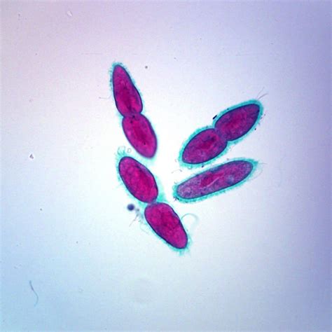 Paramecium Fission Wm Microscope Slide Southern Biological Paramecium Fission Wm Microscope Slide Southern Biological