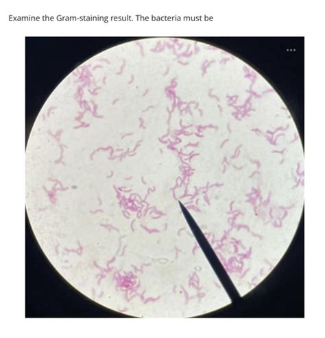 Microbiology Lab Midterm Flashcards Quizlet