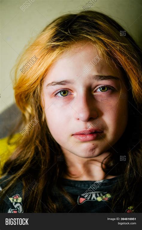 Little Sad Girl After Image And Photo Free Trial Bigstock