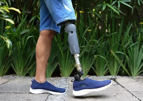 What Is A Prosthesis Types Benefits And How To Choose One