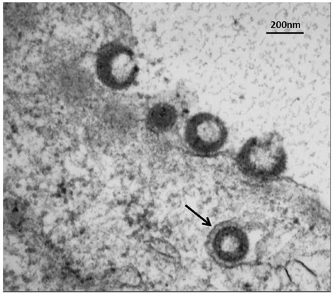 Herpes Zoster Virus Microscope
