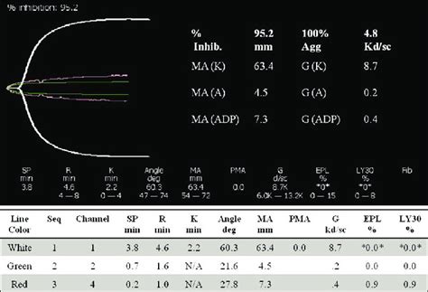 Thromboelastogram ® Platelet Mapping ™ Analysis Results For Adenosine