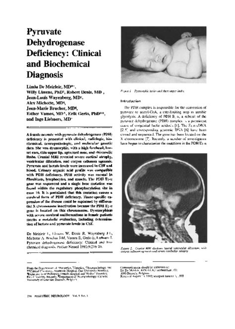 Pdf Pyruvate Dehydrogenase Deficiency Clinical And Biochemical Diagnosis
