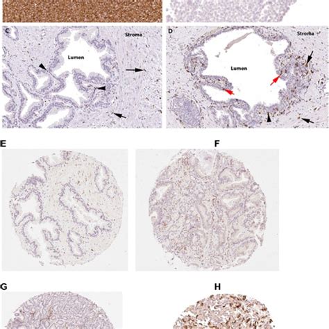 Analytical Validation Of Immunohistochemistry Detection Of Cd206