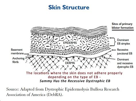 Are You Strong Enough To Be Me I Have Eb Eb Skin Lesson