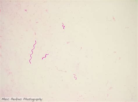 Spirostomum Under Microscope 400x