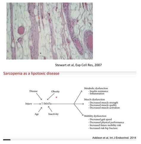 2 Oral Talks Plwh Sarcopenia Mitochondrial Function