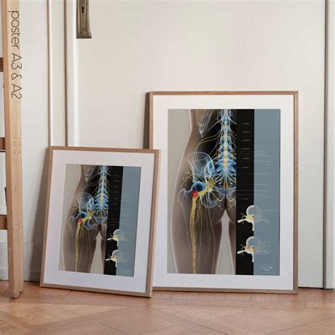 Sciatica And Stenosis Educare Design