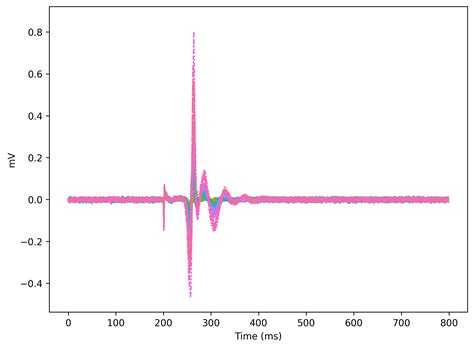 Github Jasmineherszageemg Analysis Of Emg Recordings Of Motor