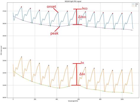 Reaping The Benefits Of An Msp430™ Mcu With Smart Analog Combo In Pulse
