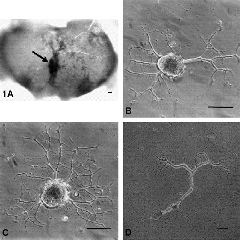 Figure 1 From Regenerating Adult Cockroach Dorsal Unpaired Median