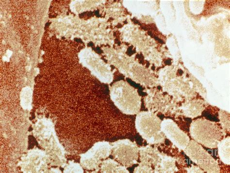 Smegma Microorganisms Sem Photograph By Scimat Fine Art America