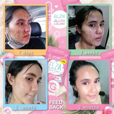 Viên Uống Trắng Da Tăng Đề Kháng Elsa Gluta Corala 60 Viên Thái Lan Giá Sỉ Giá Bán Buôn Thị