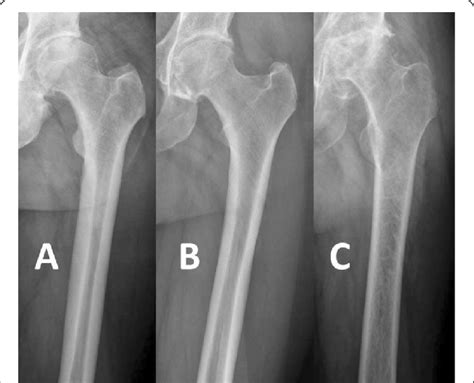 Morphological Types Described By Dorr Download Scientific Diagram