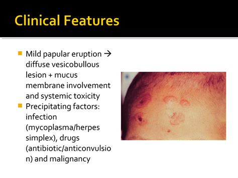 Dermatologic Emergencies Ppt