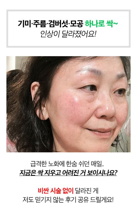 더욱 강력해진 Ms 2 Plus 골드