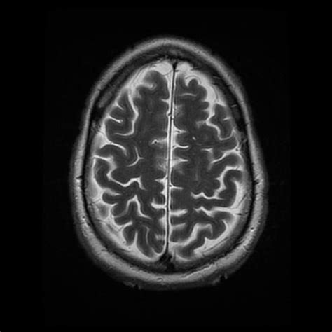 About Us CLINICAL NEUROGENOMICS STUDENTS