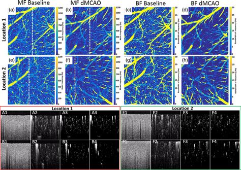 The Ed Based Algorithm Is Capable Of Visualizing And Quantifying The