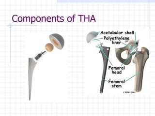 Total Hip Arthroplasty For Ccu Ppt