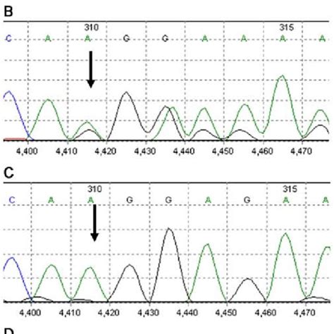 Sptb Protein Structure Prediction Using The Swiss Model Software A