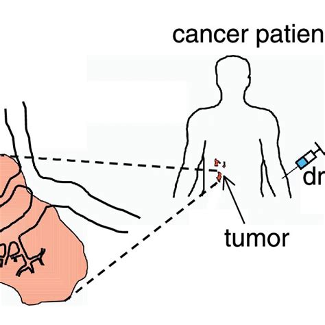 Schematic Representation Of Tumor Targeting An Agent Injected