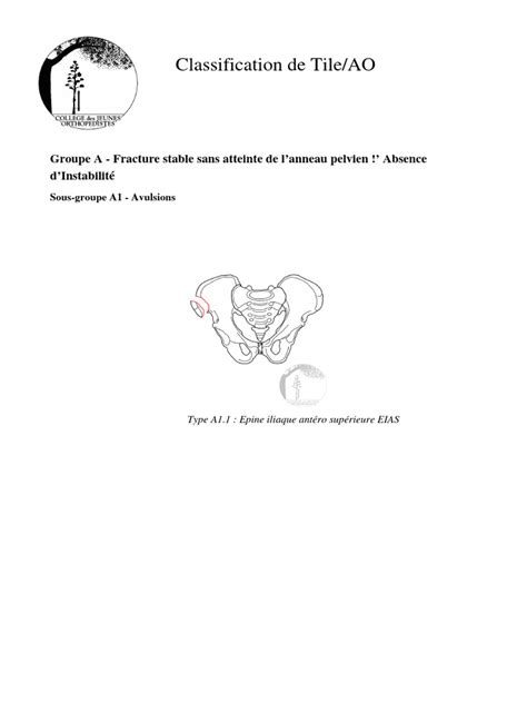 Classification De Tile Ao Pdf