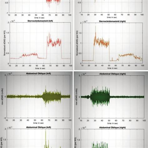 Schematic Representation Of The Location Of Surface Electromyography