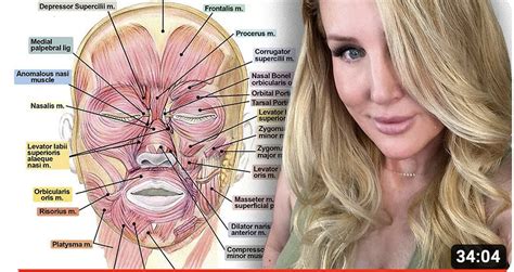 Time For Botox Custom Mapping And Mistakes To Avoid
