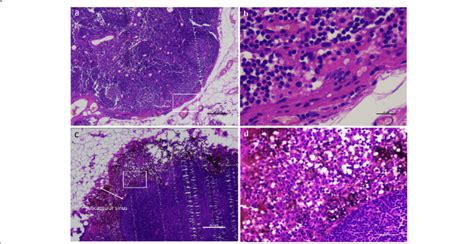 A And B Normal Lymph Node Section Without Carbon Nanoparticle Staining