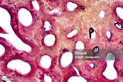 Spongy Bone Under Microscope
