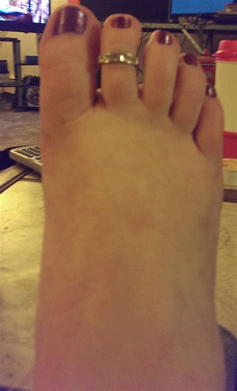 Toe Ring Rfeetpics