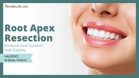 Root Apex Resection Enhance Oral Comfort And Stability Trambellir
