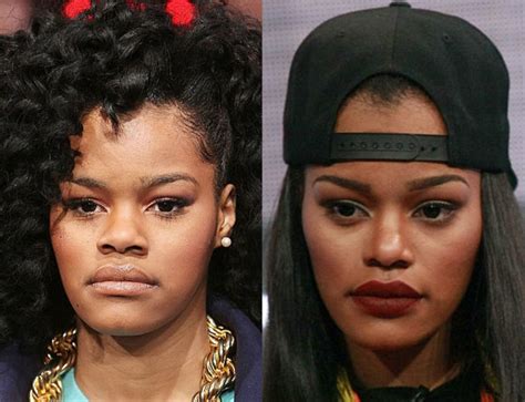 Teyana Taylor Before And After Plastic Surgery Celebrity Plastic