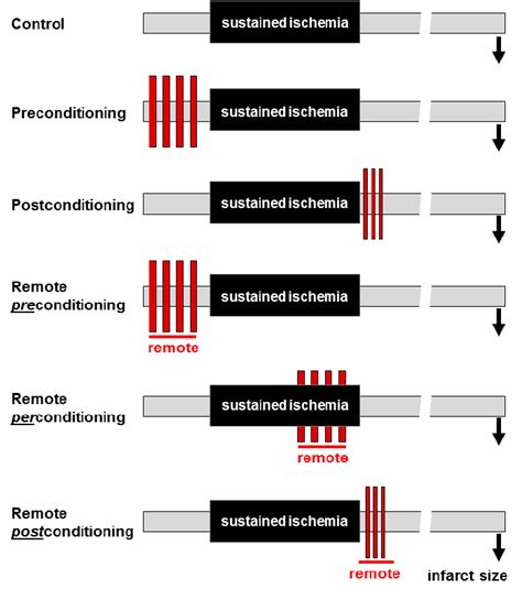 Schematic Diagram Illustrating The Key Temporal Aspects Of