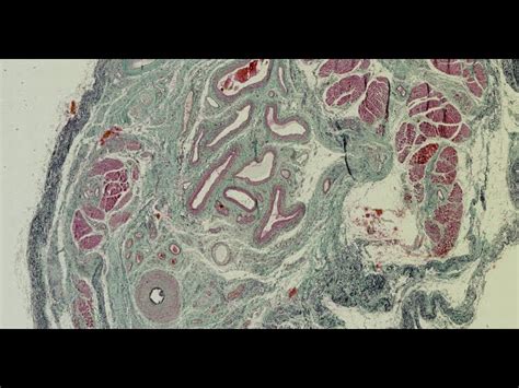 Pampiniform Plexus Histology