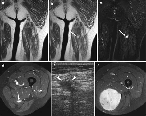 Staging Radiology Key