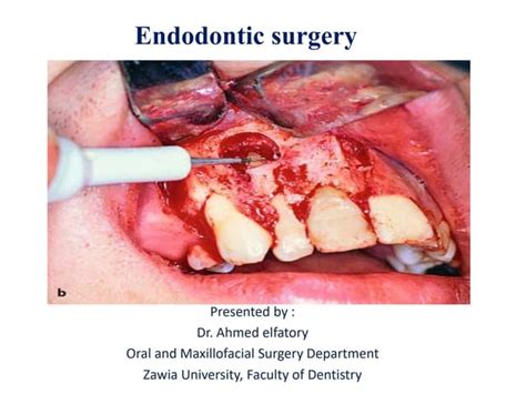 Scope Of Endodontics In Dentistry Required By Dentists As We Know The