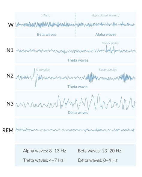 Narcolepsy Brain Waves