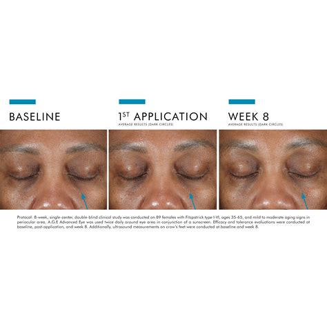 Skinceuticals Age Advanced Eye Sf Wellness