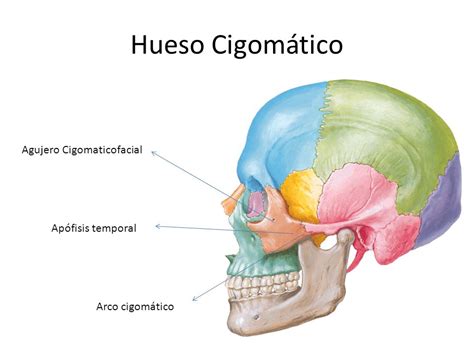 Arco Cigomatico2 Arco Cigomatico