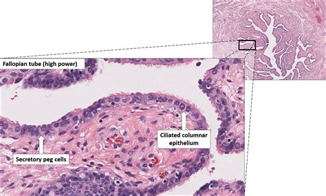 Uterine Tube Slide Oviduct Fallopian Tube Tutorial Histology