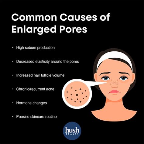 6 Medical Tips To Prevent And Treat Enlarged Pores Hush Beauty Md