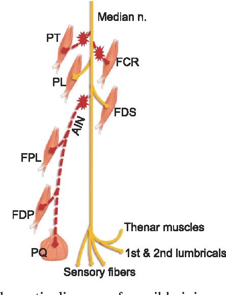 Anterior Interosseous Nerve