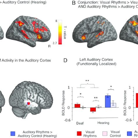 The Auditory Cortex Processes Rhythm Independently Of Sensory Modality Download Scientific