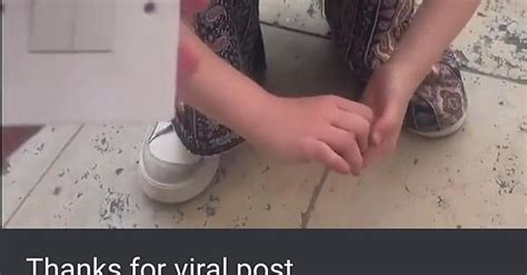 Imgur Bugs Get Gross Sometimes Album On Imgur