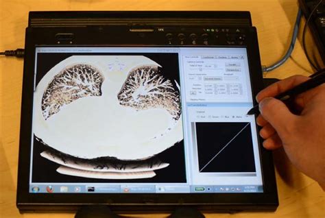 7 Video Streams Generated By Ic Nodes Are Displayed On A Tablet A